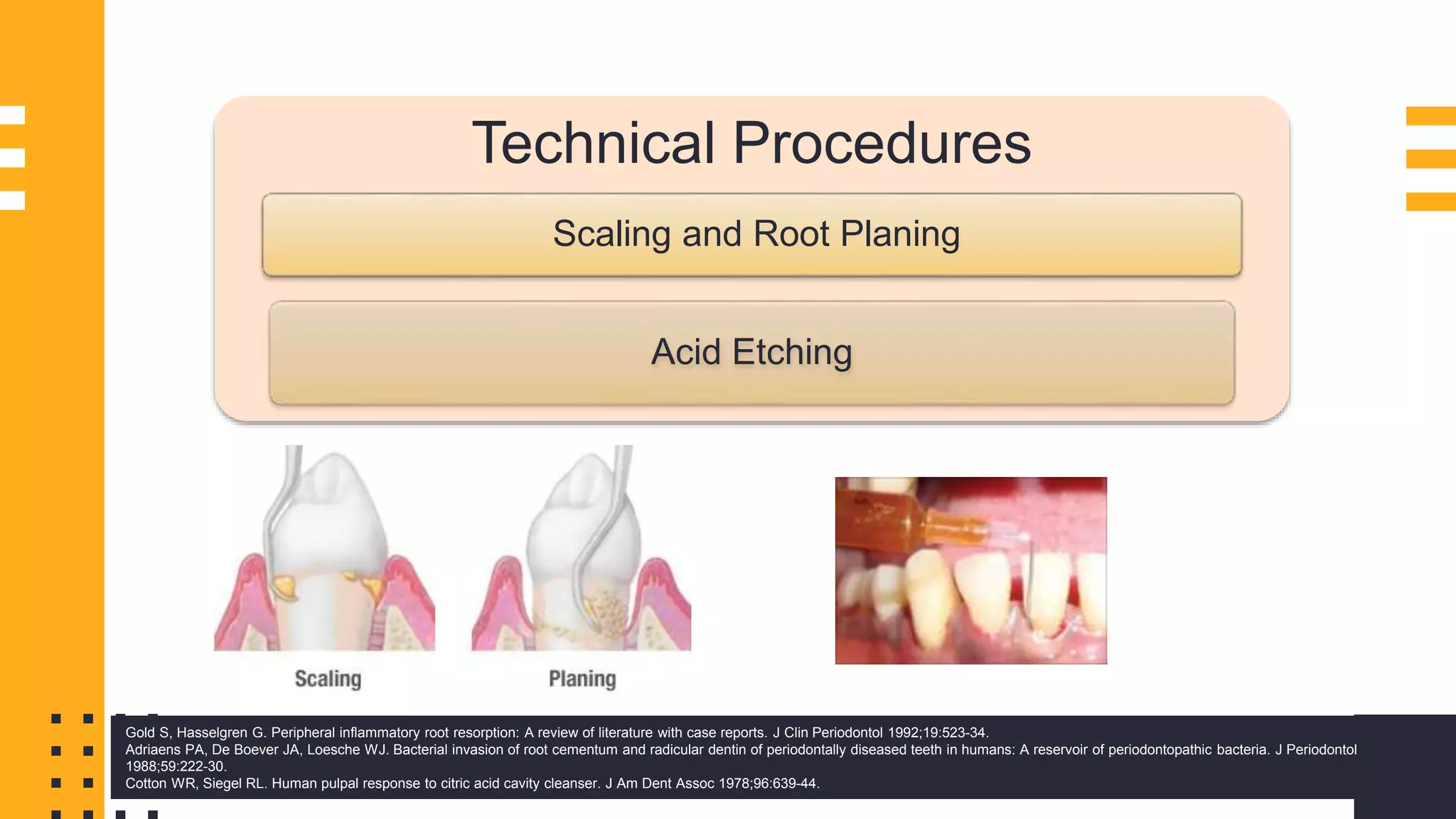 Endo Perio Lesions | PPTX