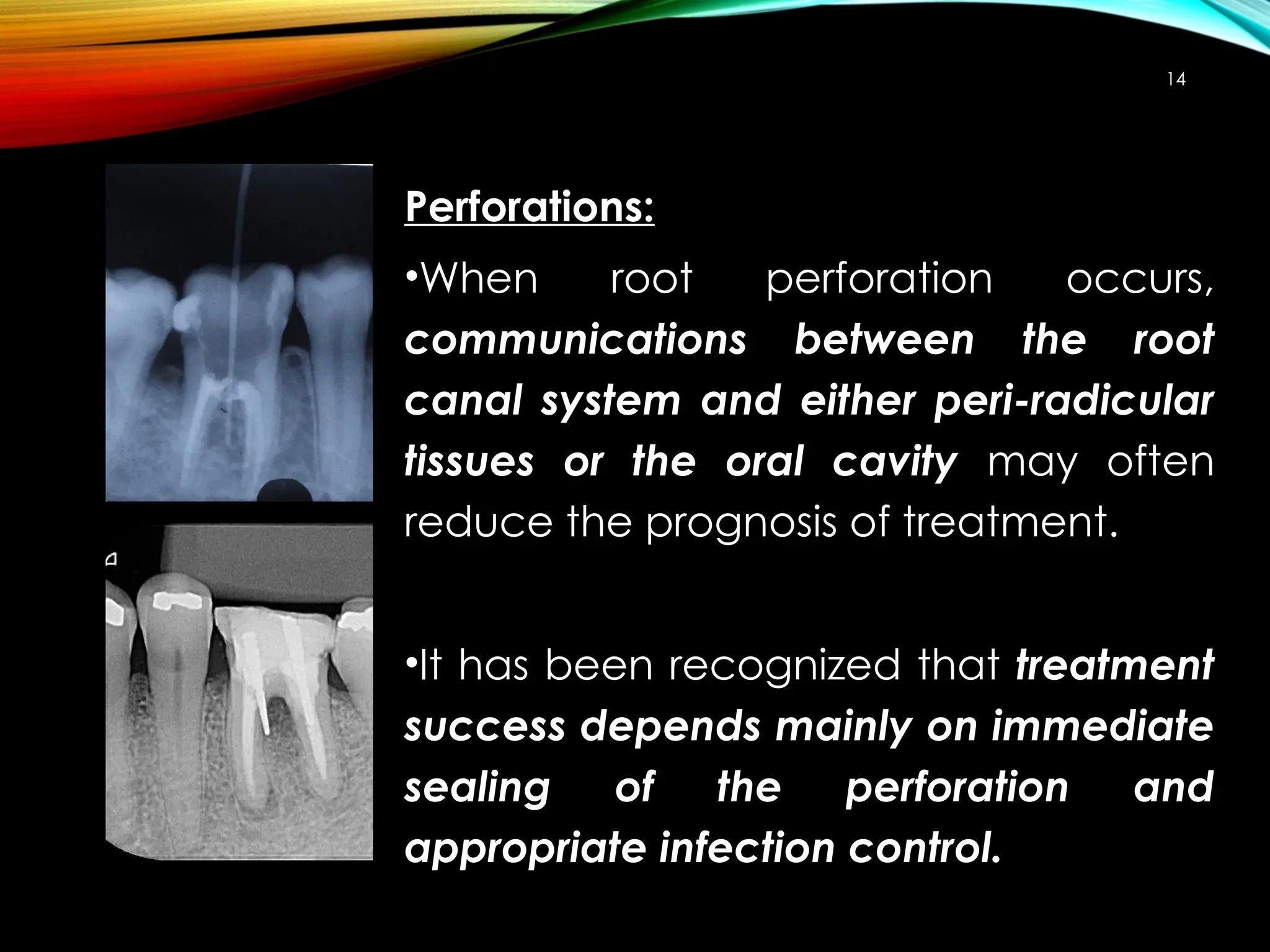 ENDO-PERIO LESIONS is one and both pulp and periodontal tissue are ...