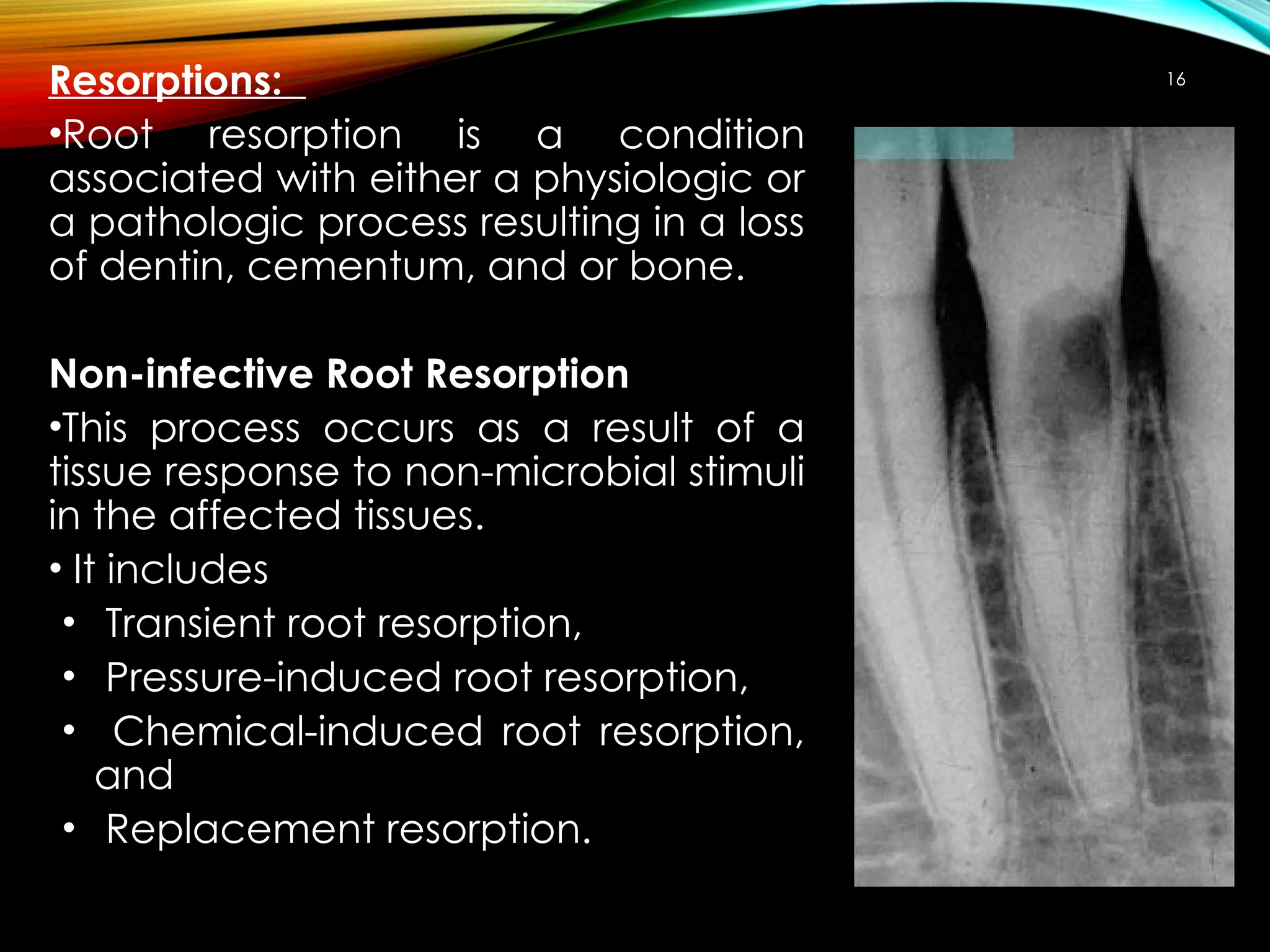 ENDO-PERIO LESIONS is one and both pulp and periodontal tissue are ...