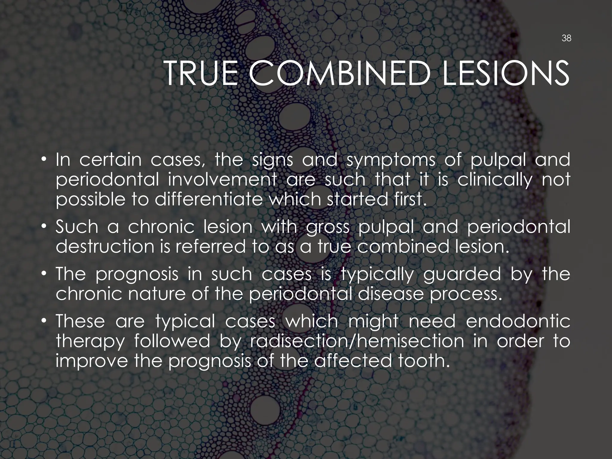 ENDO-PERIO LESIONS is one and both pulp and periodontal tissue are ...