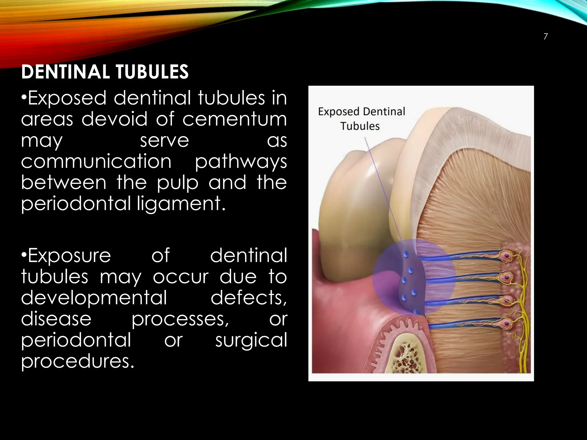 ENDO-PERIO LESIONS is one and both pulp and periodontal tissue are ...