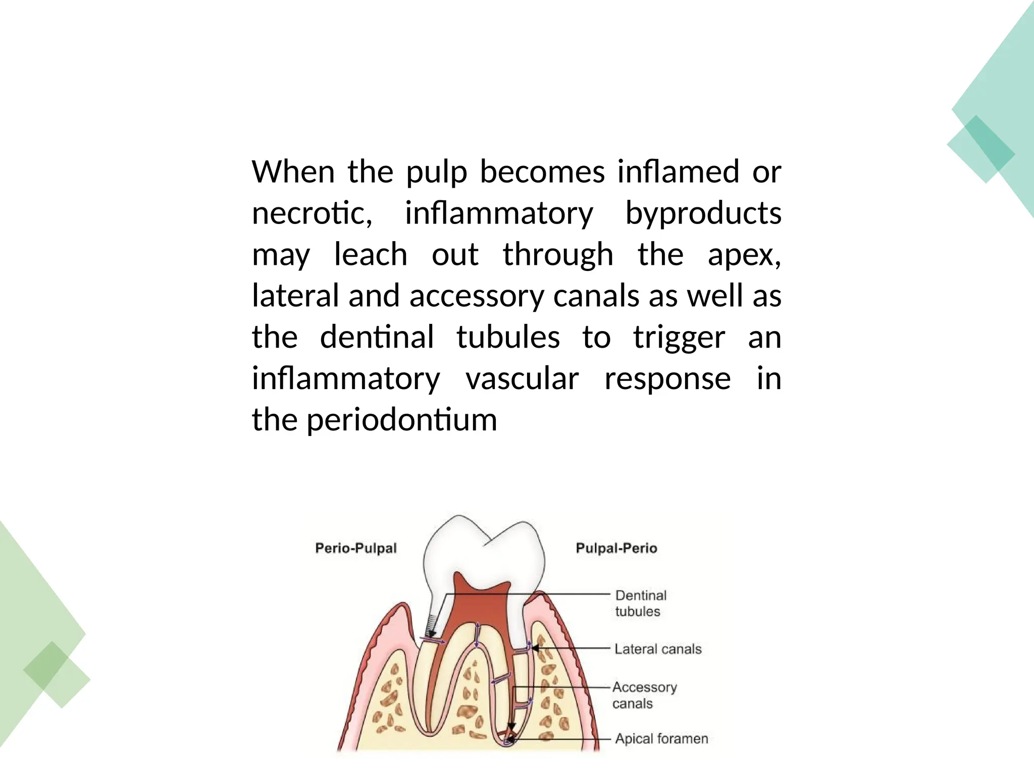 endo-perio lesions or perio endo lesion16-06-21.pptx