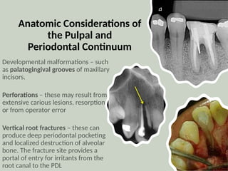 endo-perio lesions or perio endo lesion16-06-21.pptx