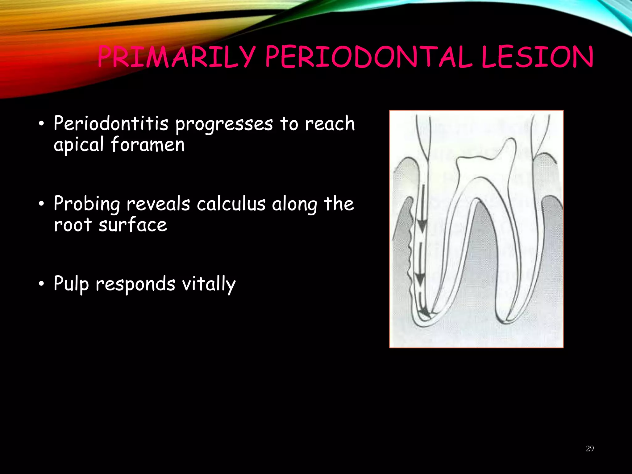 ENDO-PERIO LESIONS.ppt
