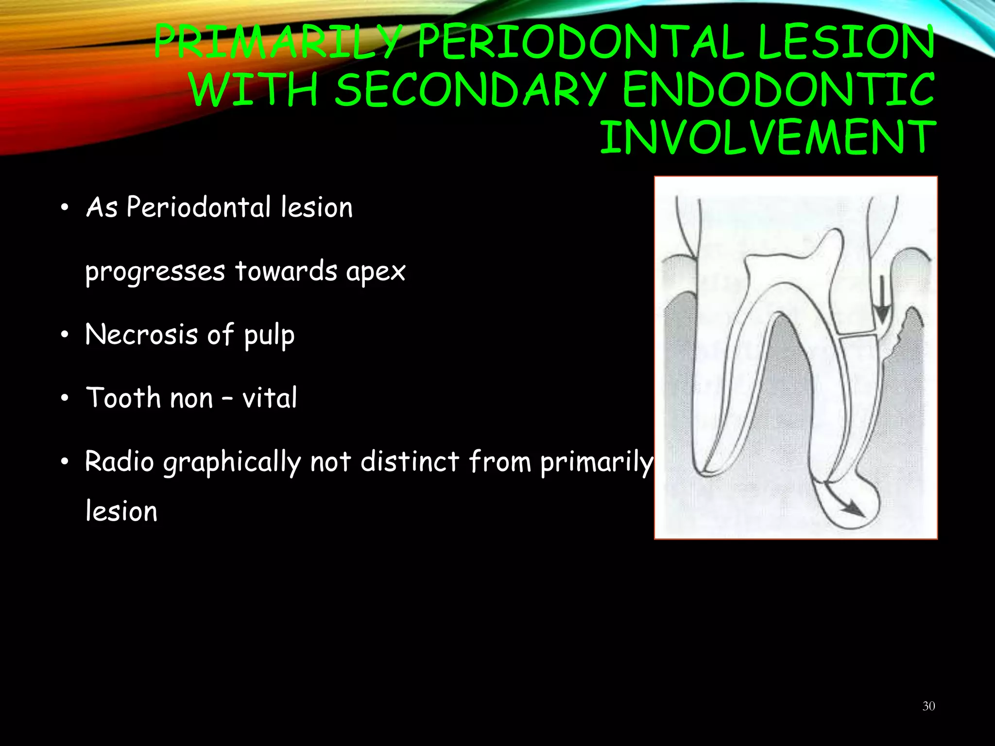 ENDO-PERIO LESIONS.ppt