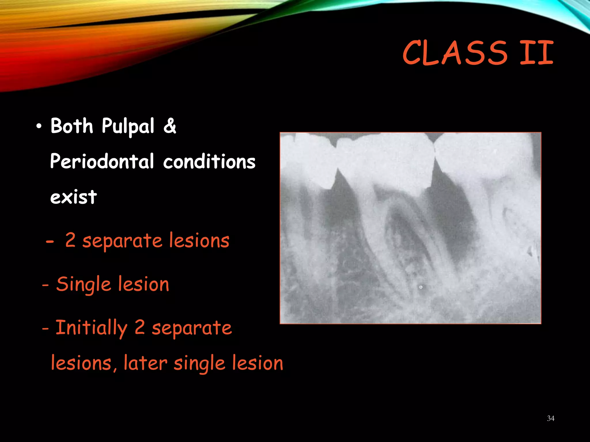 ENDO-PERIO LESIONS.ppt