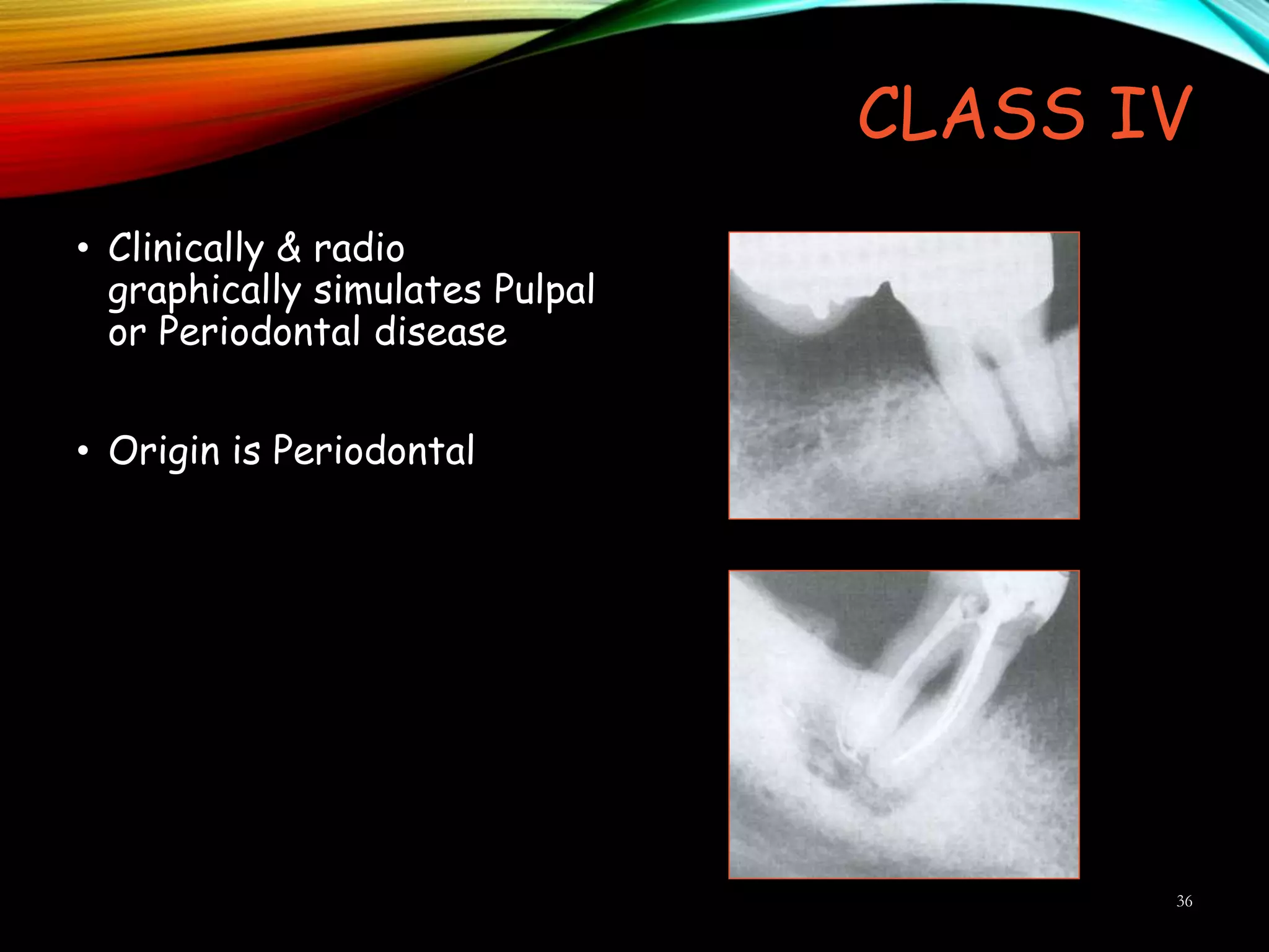 ENDO-PERIO LESIONS.ppt