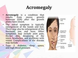 Endocrine Glands | PPSX