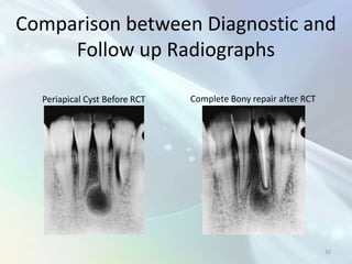 Radiology in Endodontics | PPTX