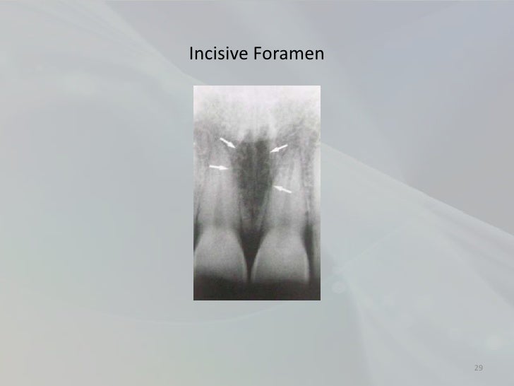 Radiology in Endodontics