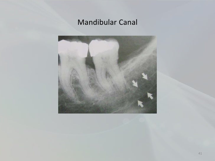 Nutrient Canal Radiograph ADAE International... ADAE International