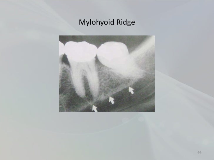 Radiology in Endodontics