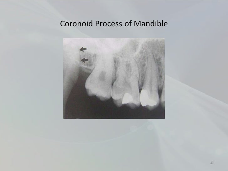 Radiology in Endodontics