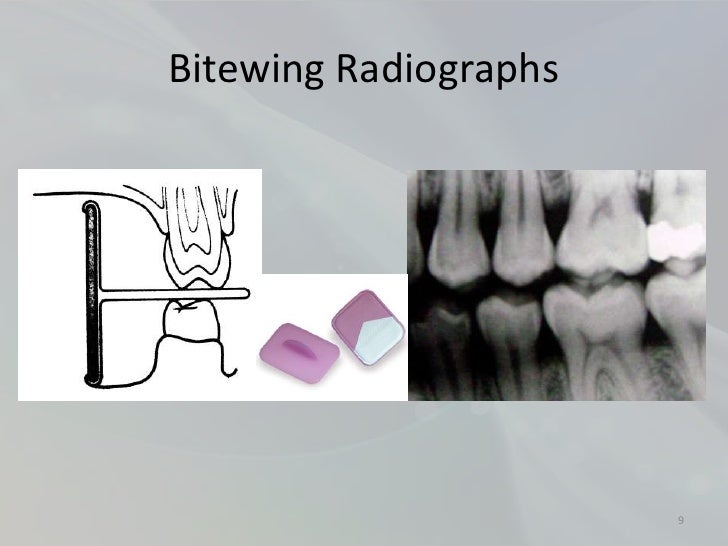 Radiology in Endodontics