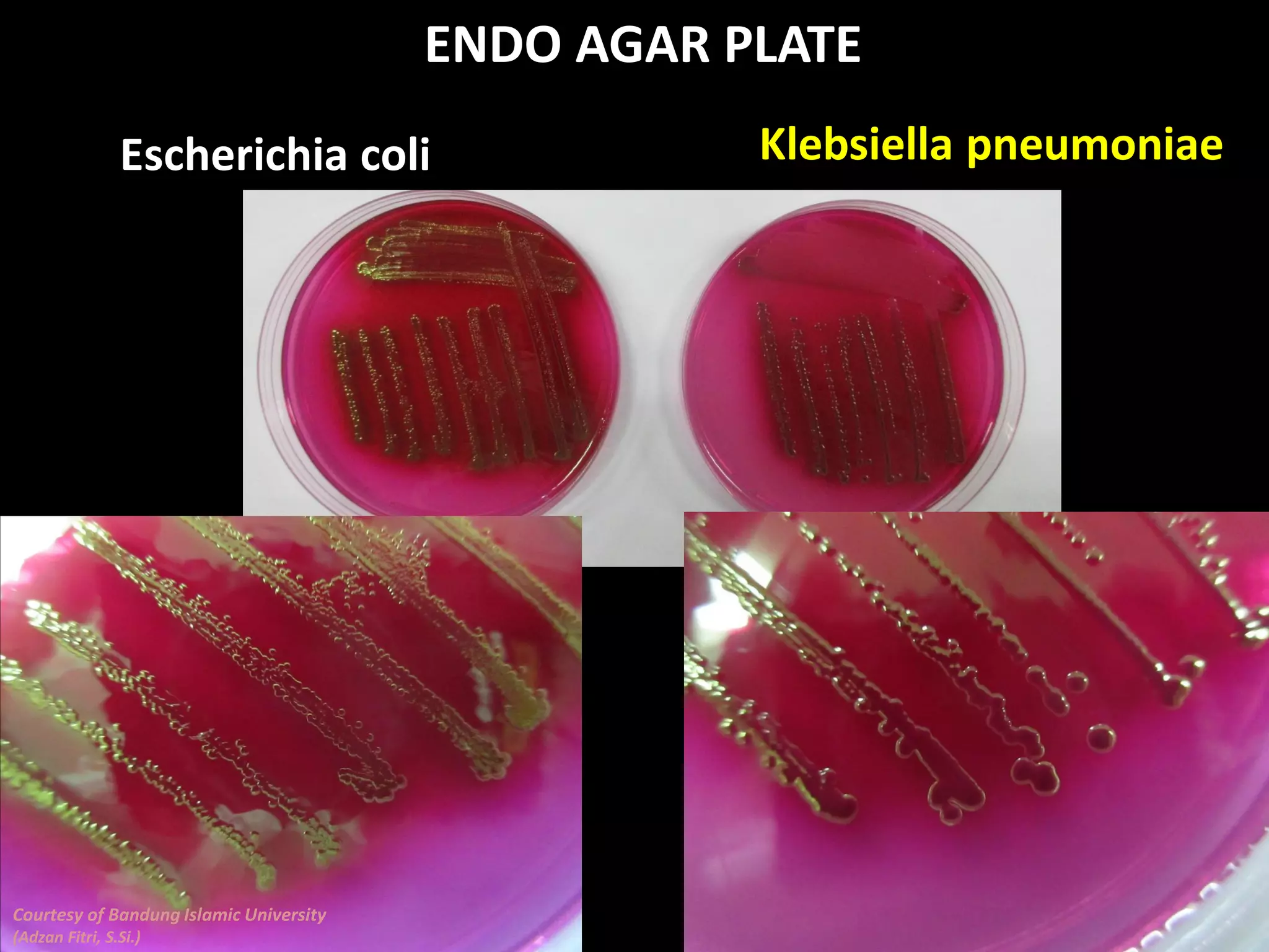 Escherichia coli and Klebsiella pneumoniae (UNISBA - Indonesia) | PPT
