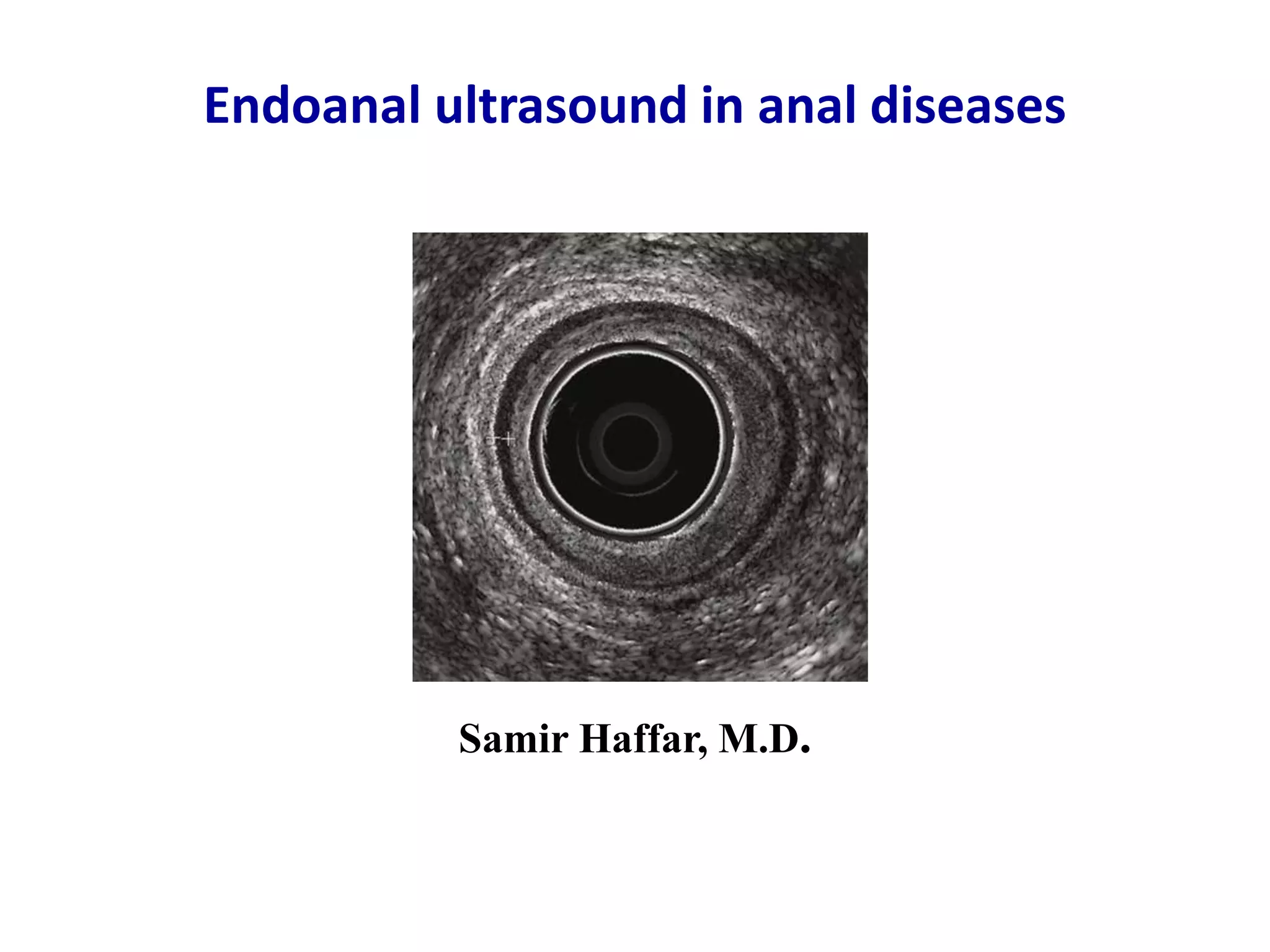 Endoanal ultrasound in anal diseases | PPTX