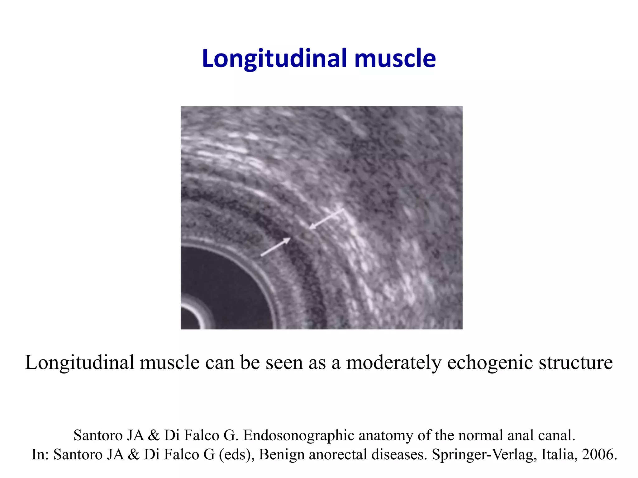 Endoanal ultrasound in anal diseases | PPTX