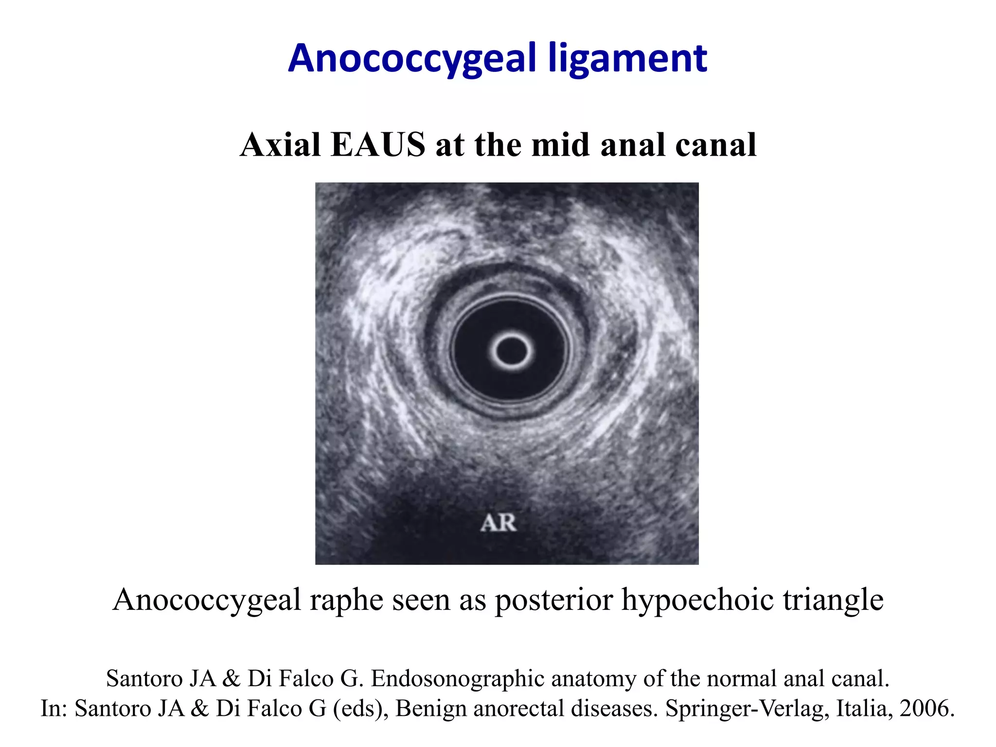 Endoanal ultrasound in anal diseases | PPTX