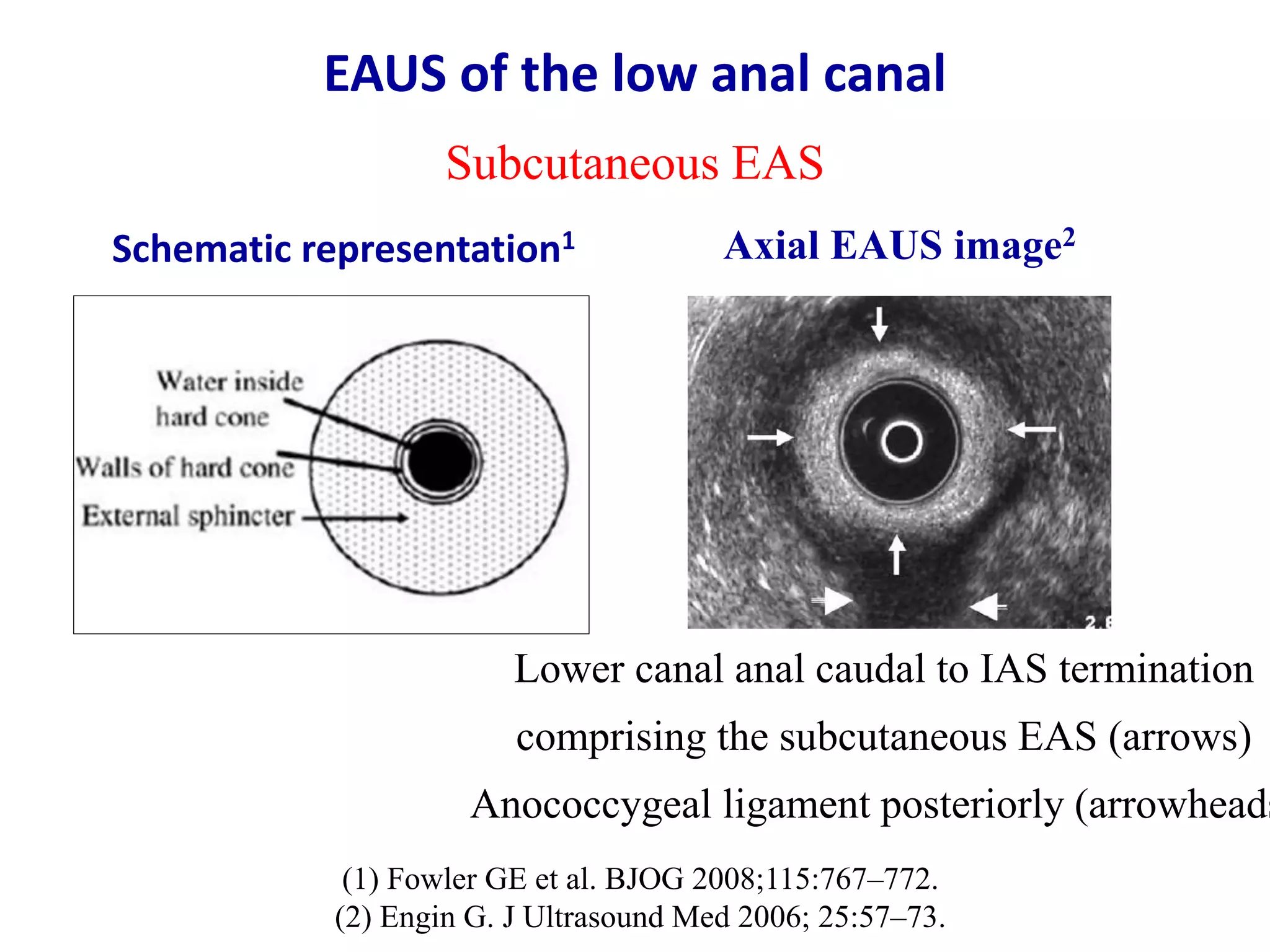 Endoanal ultrasound in anal diseases | PPTX
