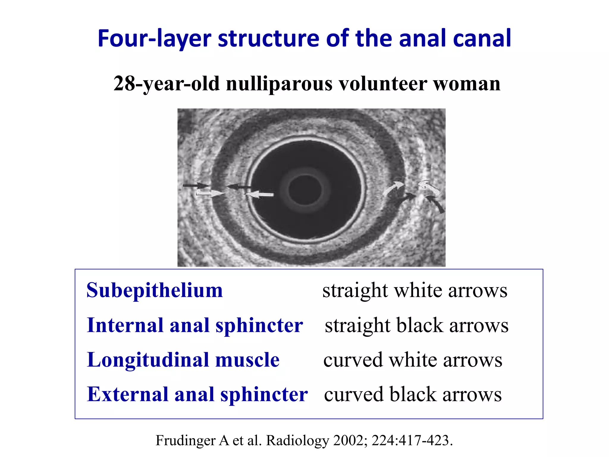 Endoanal ultrasound in anal diseases | PPTX