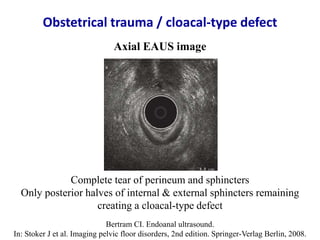 Endoanal ultrasound in anal diseases | PPTX