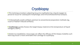 Endobronchial Cryotherapy.pptx