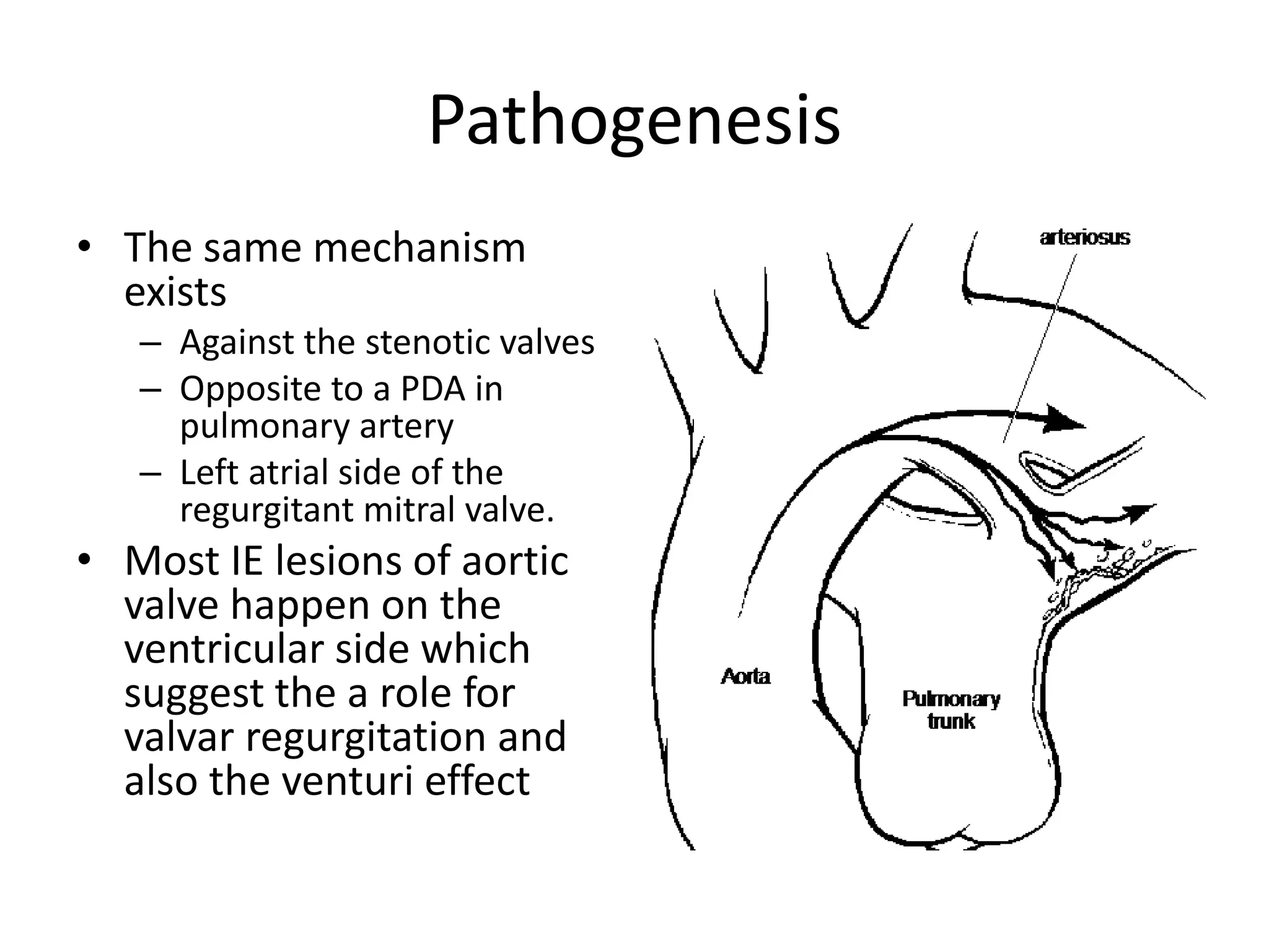 Infective Endocarditis and It's Surgical Management | PPTX