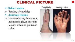 Infective Endocarditis | PPT