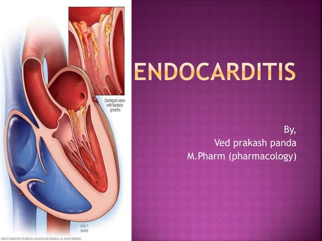 Endocarditis | PPT
