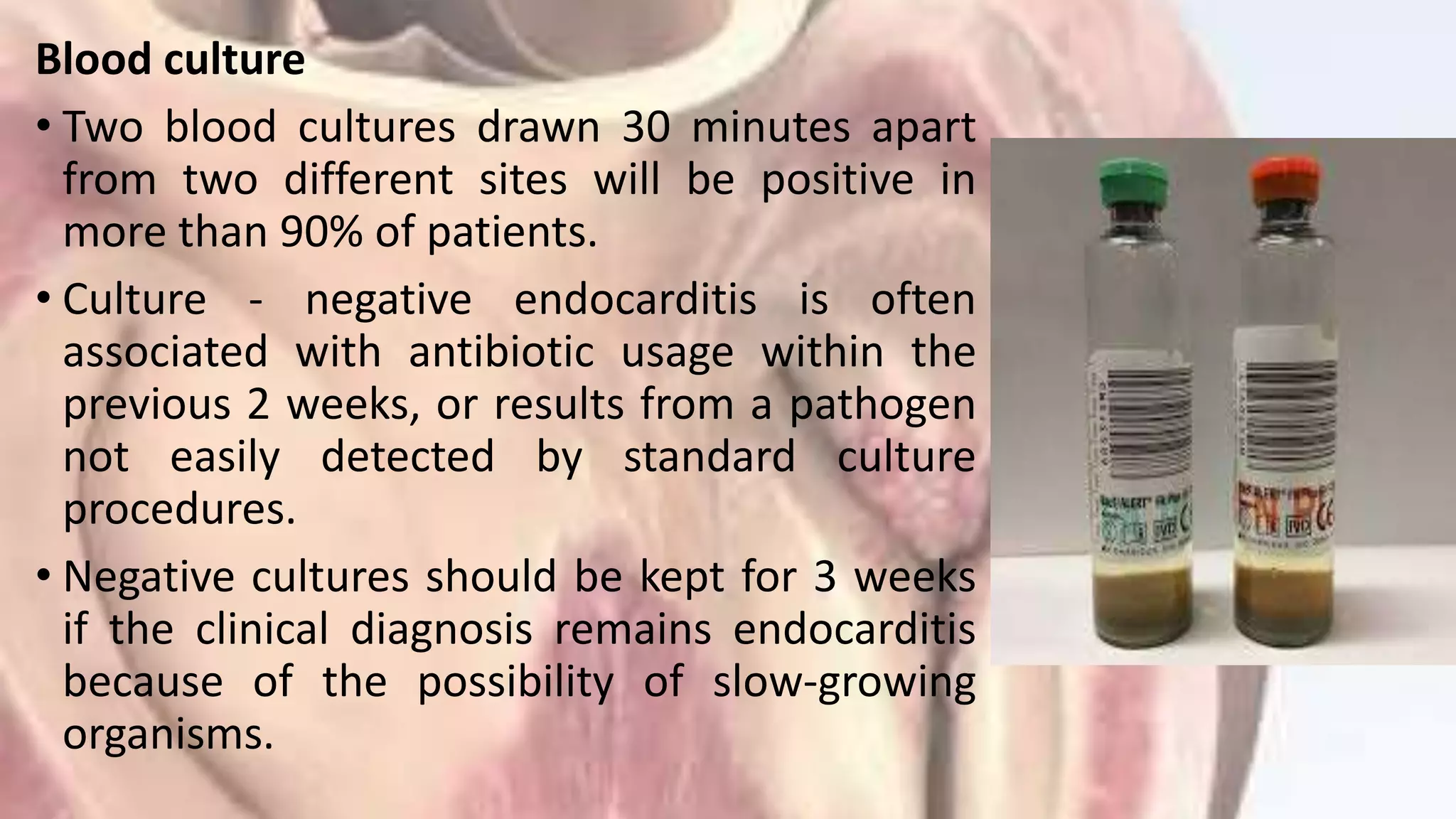 Endocarditis and its management | PPTX