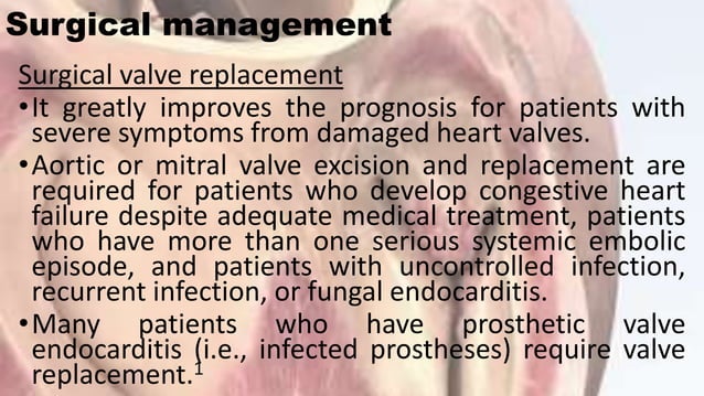 Endocarditis and its management | PPTX | Heart and Cardiovascular ...