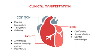 Endocarditis | PPT