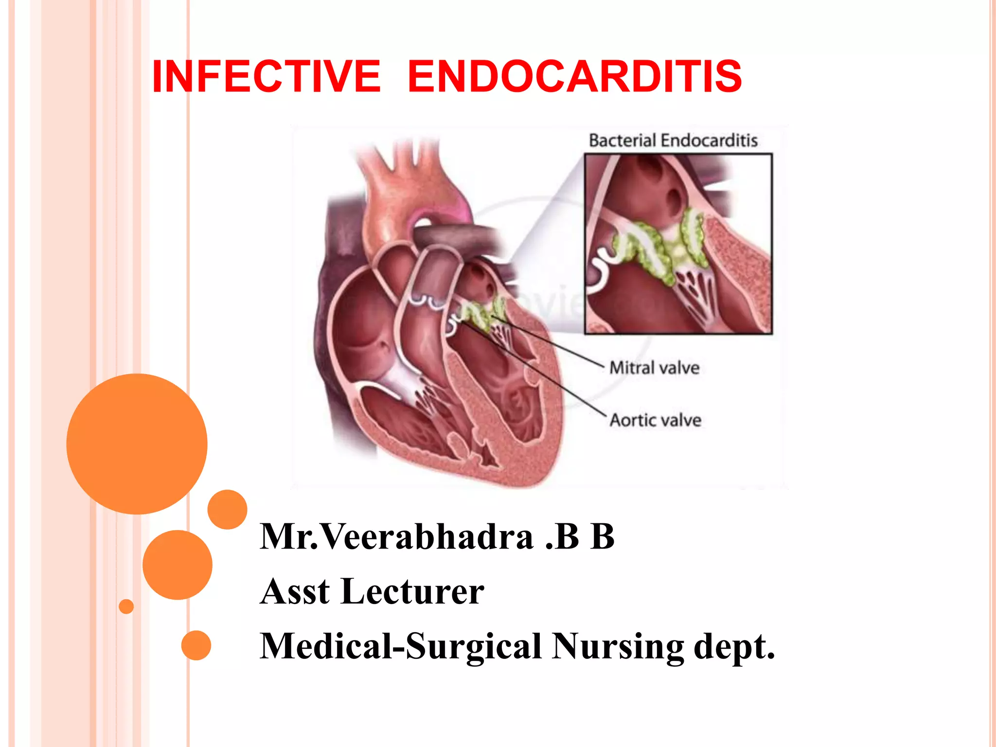 Endocarditis | PPTX