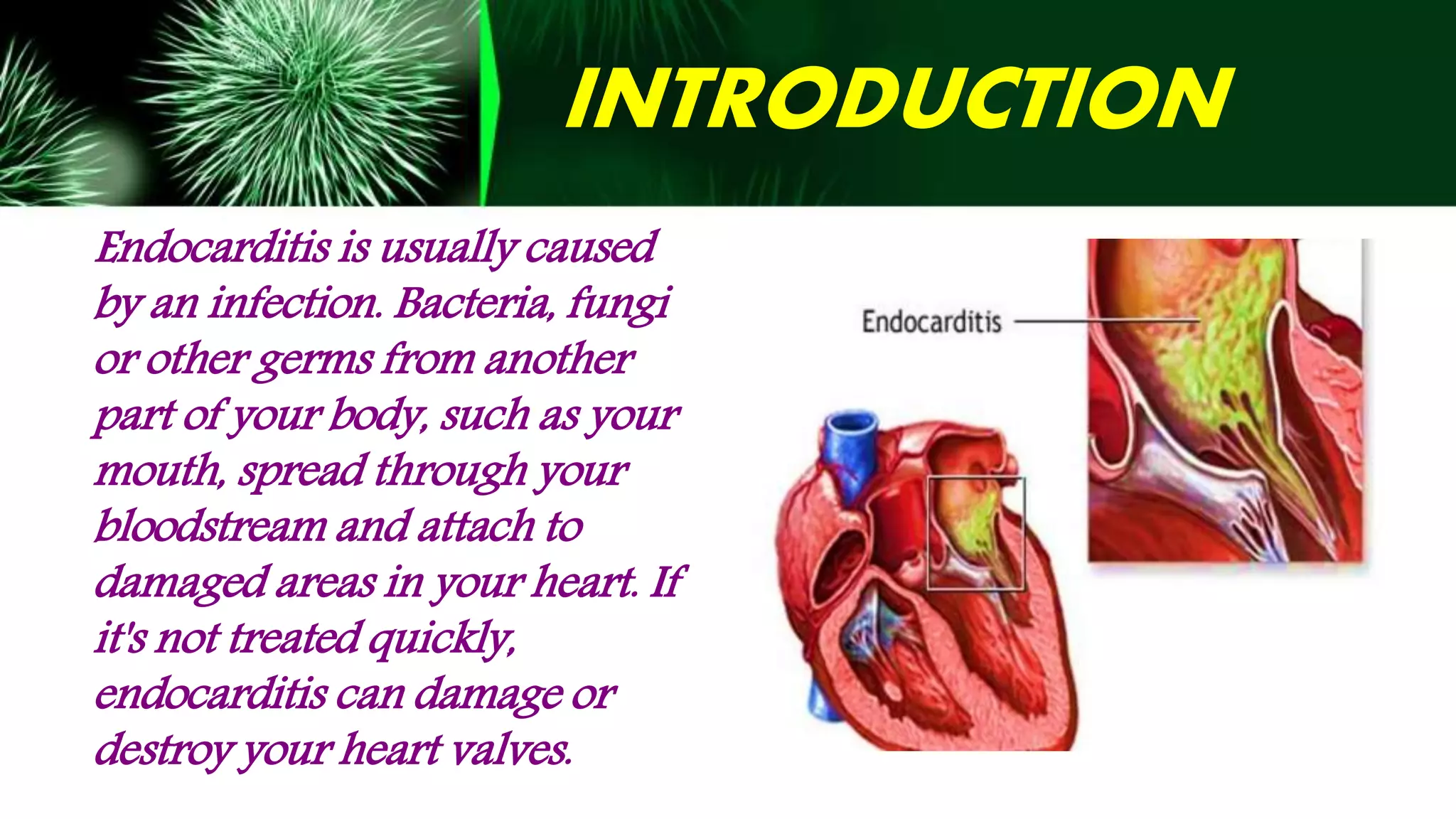 Endocarditis | PPTX