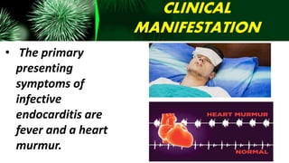 Endocarditis | PPTX