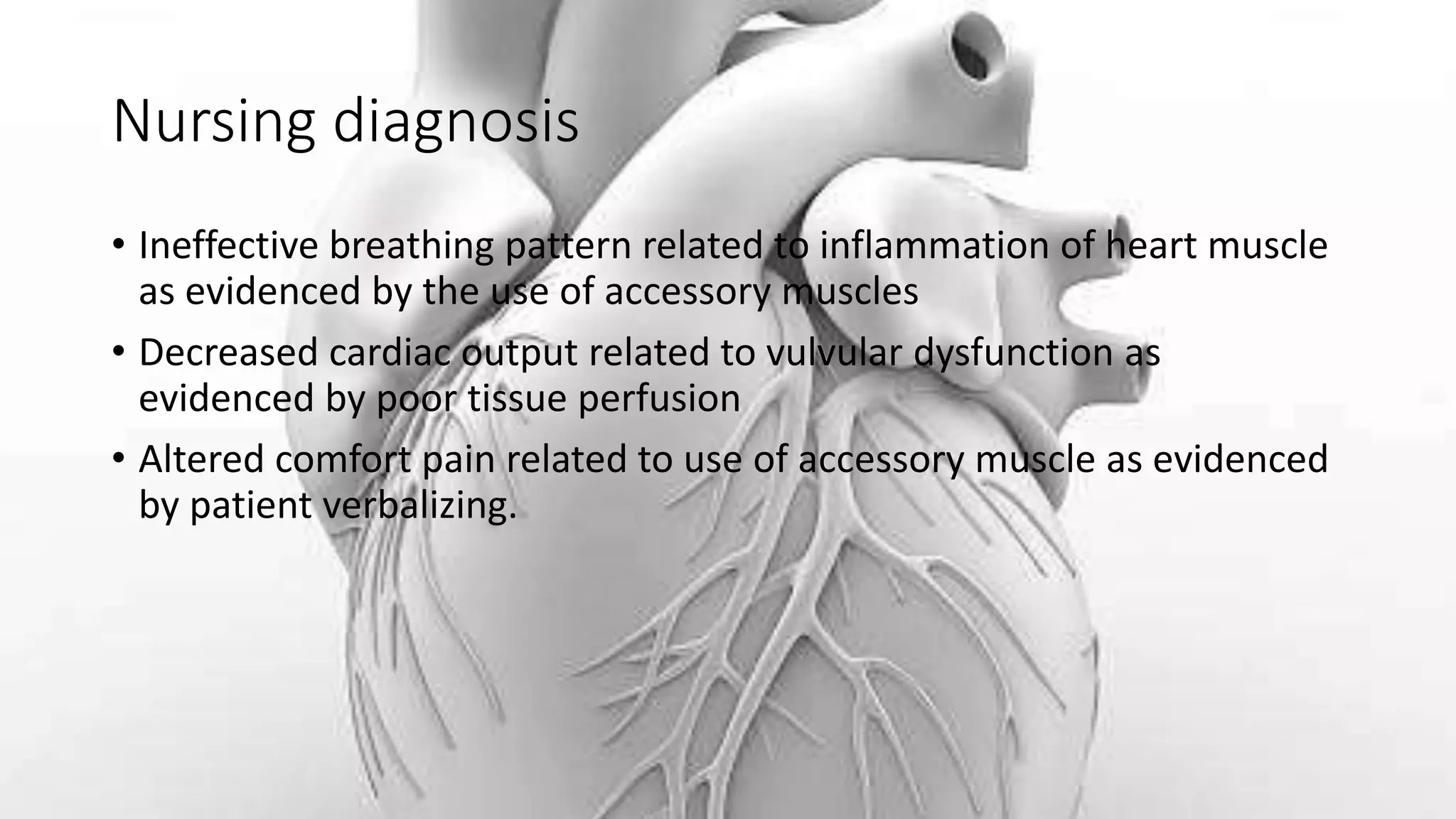 ENDOCARDITIS.pptx
