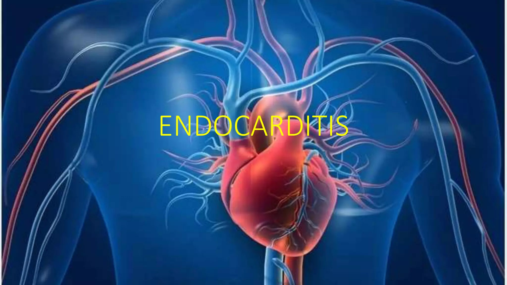 ENDOCARDITIS.pptx