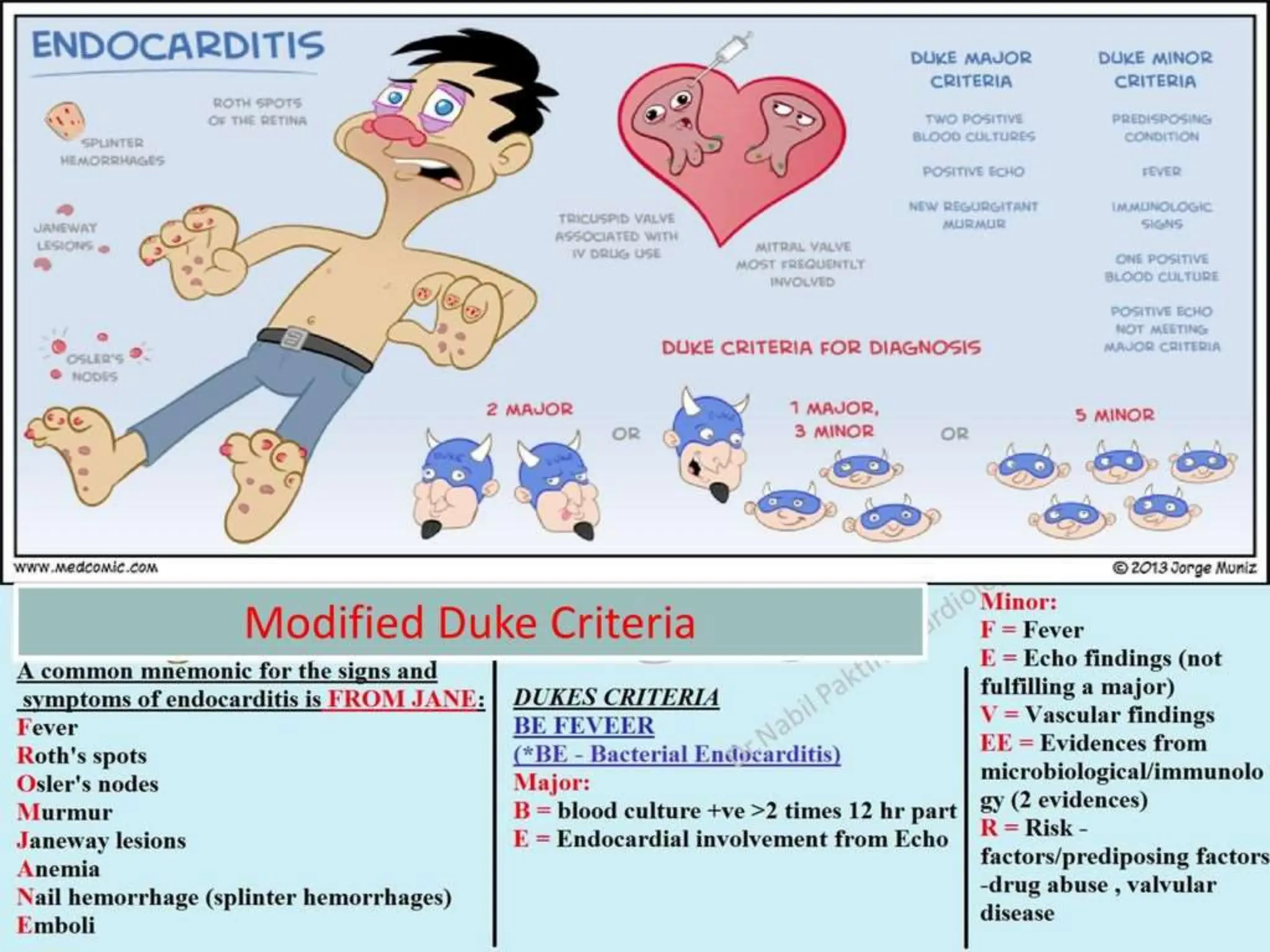 Infective Endocarditis (IE) Lecture pptx | PPTX