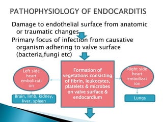 Endocarditis.pptx