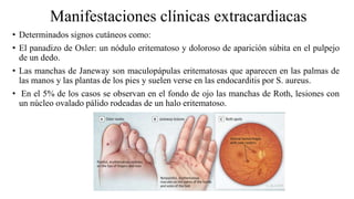 endocarditis.pptx universidad ciencias de la salud | PPT