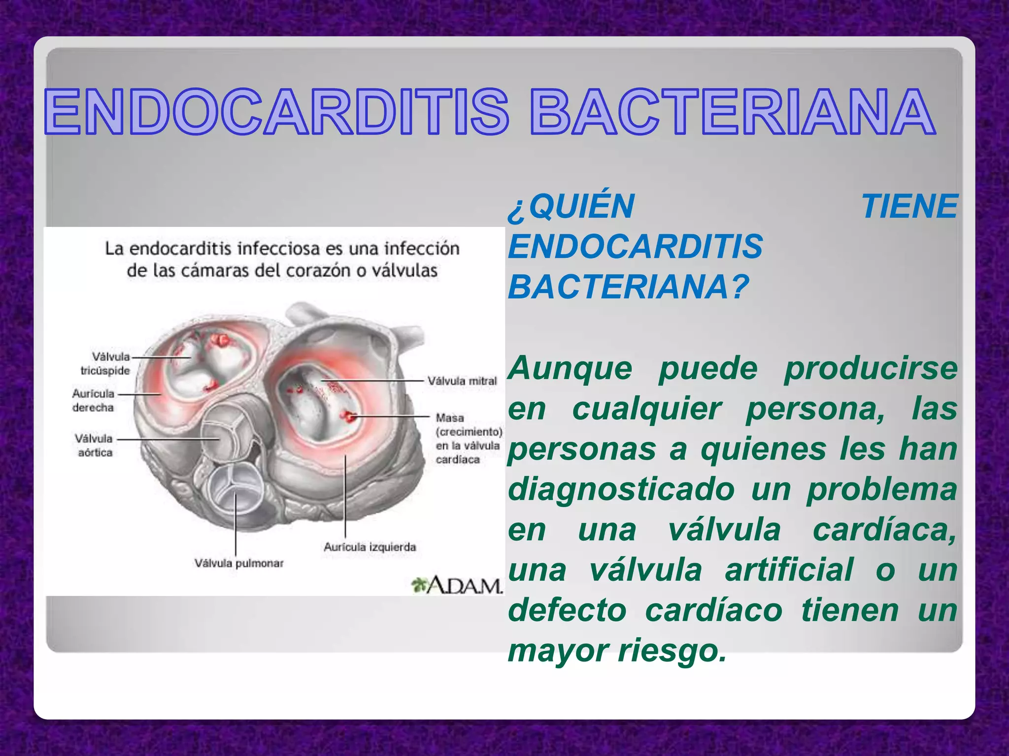 Endocarditis bacteriana | PPT