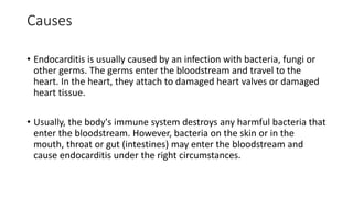 Endocarditis (1).pptx