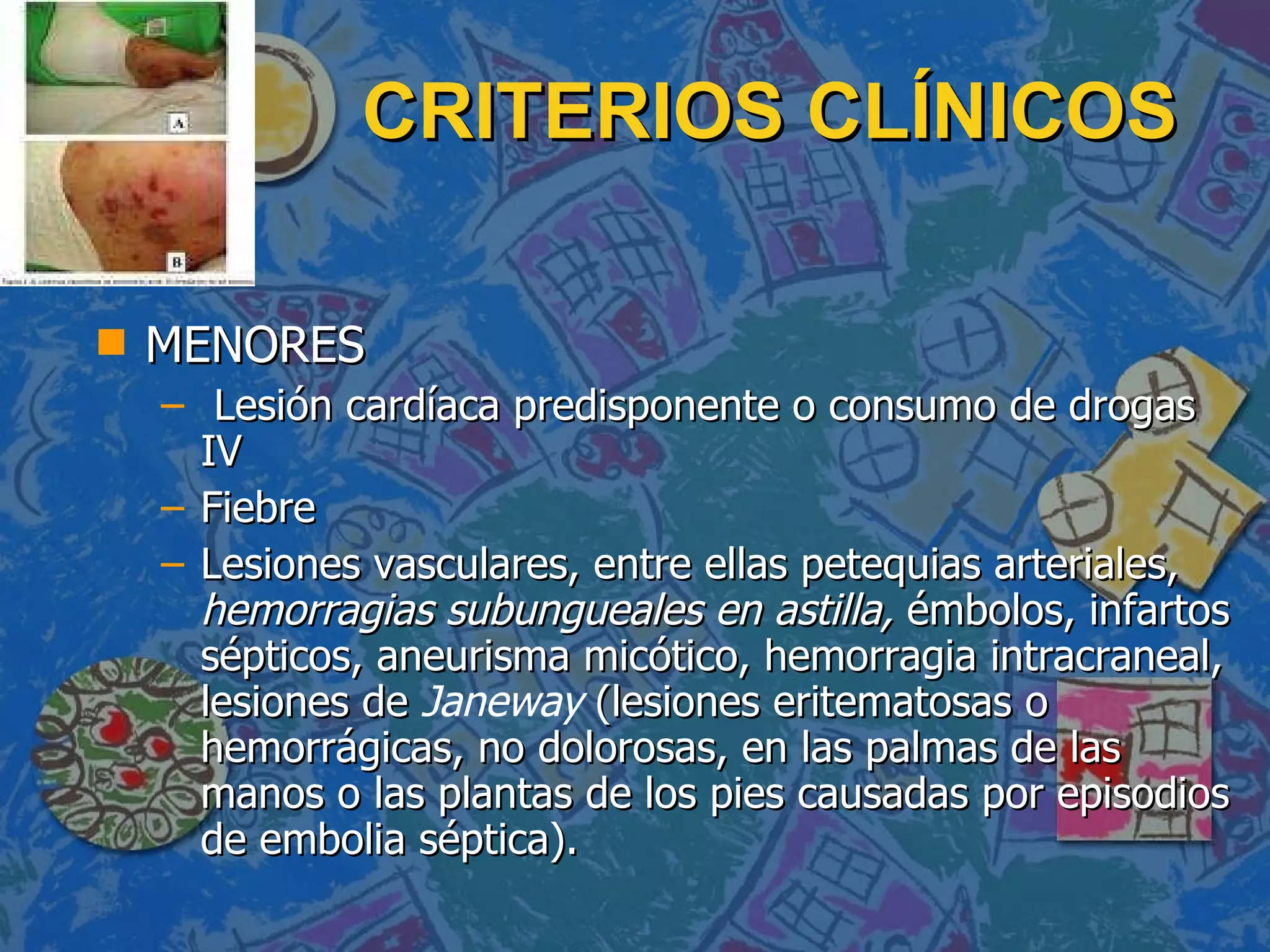 Endocarditis infecciosa | PPT