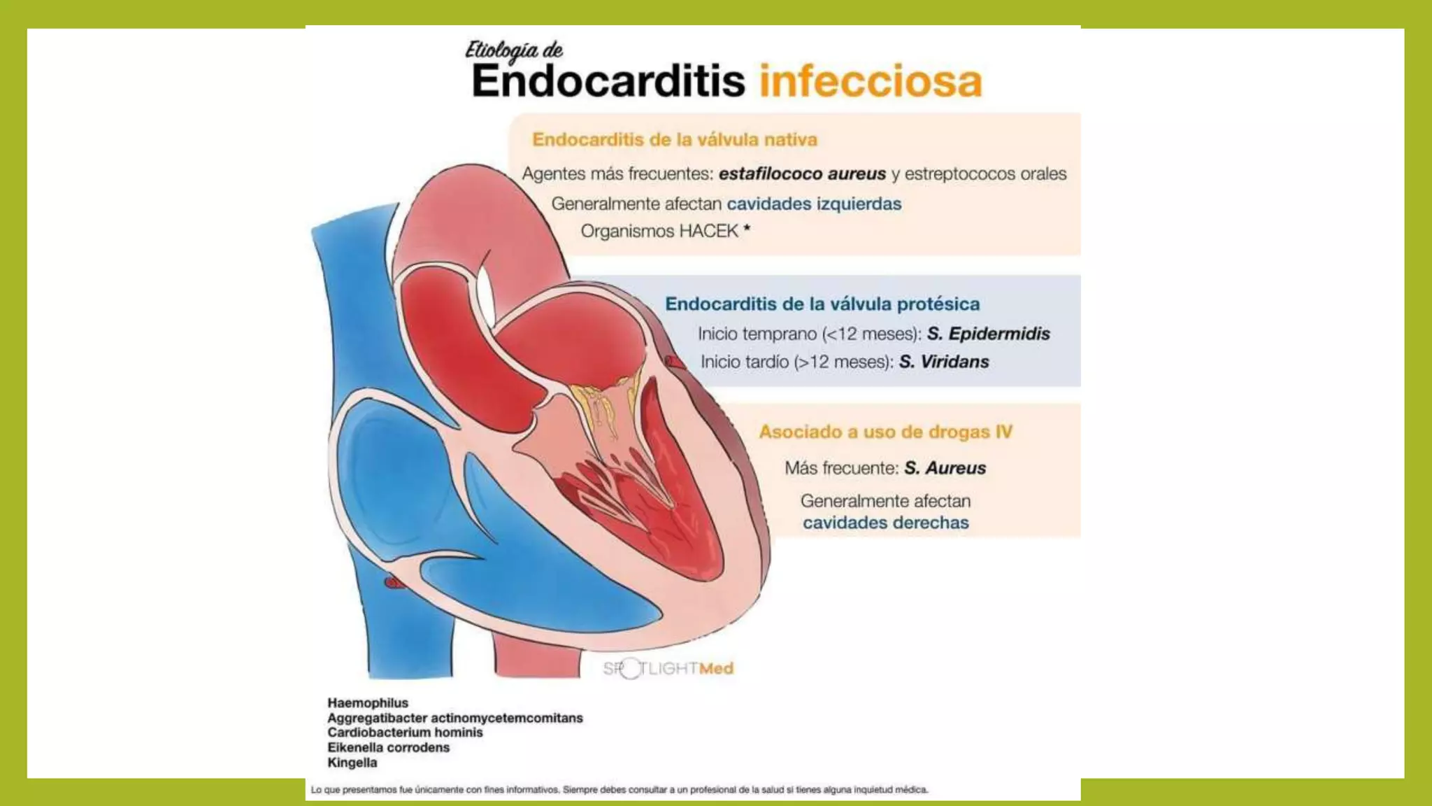 Endocarditis_Infecciosa.pptx