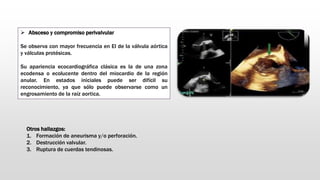 endocarditis infecciosa, diagnóstico y etiología | PPT
