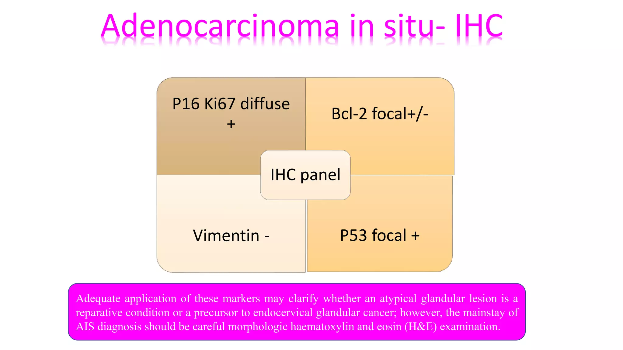 Diagnostic challenges in endocervical adenocarcinoma | PPTX