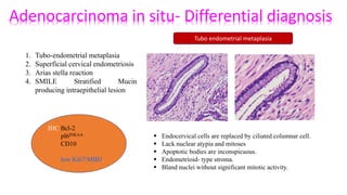 Diagnostic challenges in endocervical adenocarcinoma | PPTX