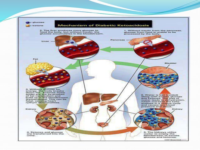 Endocrine Emergency Part 1 | PPTX | Thyroid Disorders | Endocrine and ...