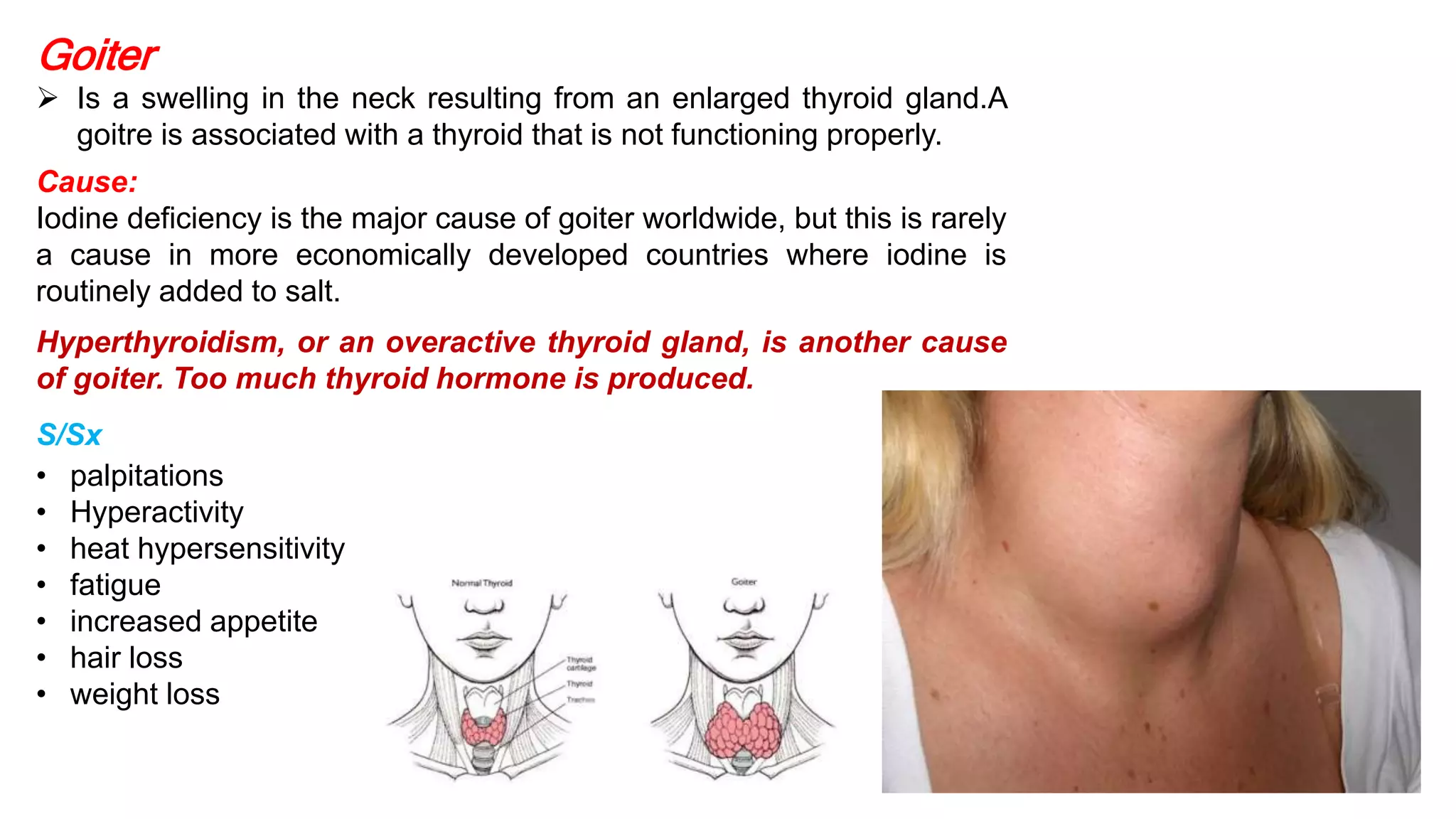 Endocrine DIseases | PPTX