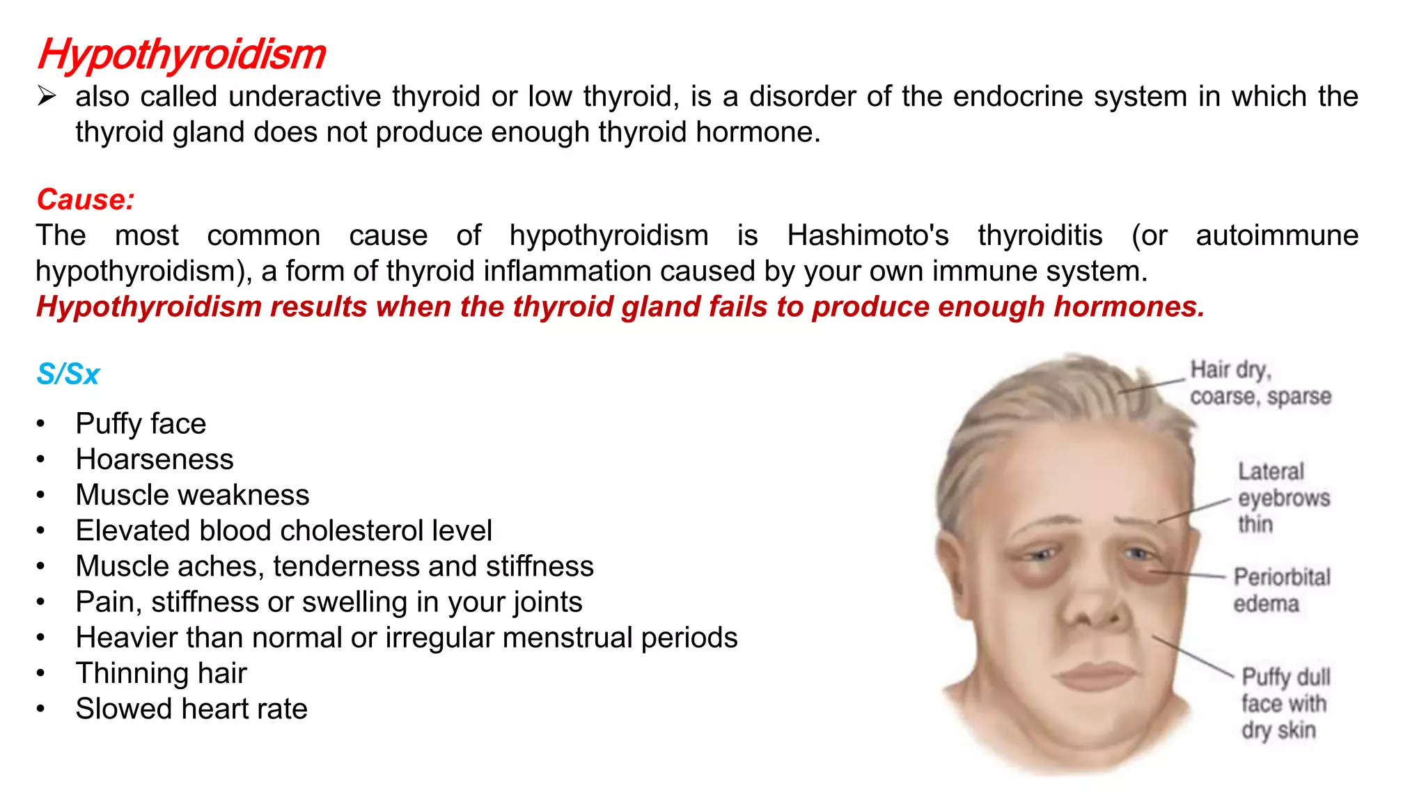 Endocrine DIseases | PPTX